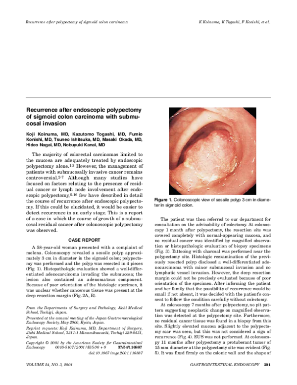 (PDF) Recurrence after endoscopic polypectomy of sigmoid colon ...