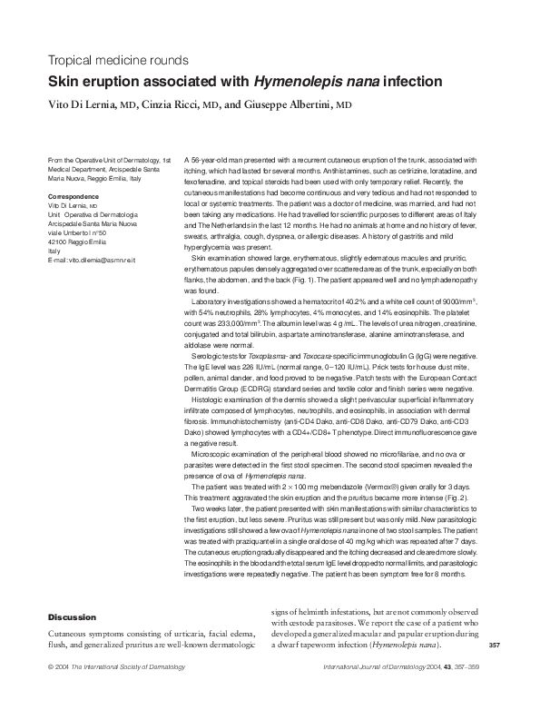 (PDF) Skin eruption associated with Hymenolepis nana infection