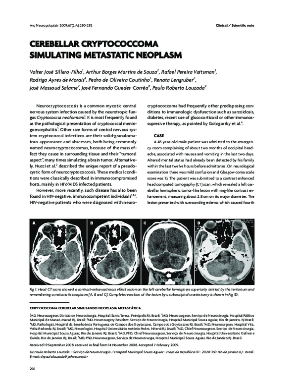 (PDF) Cerebellar cryptococcoma simulating metastatic neoplasm