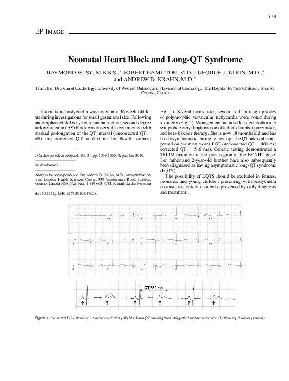 (PDF) Neonatal Heart Block and Long-QT Syndrome