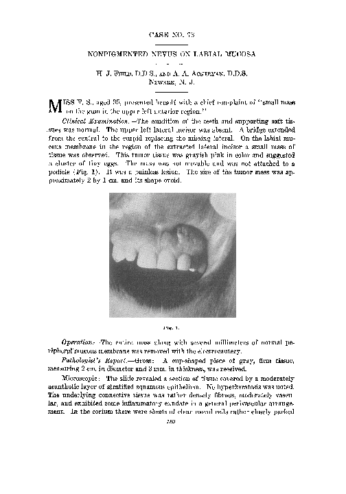 (PDF) Case reports: Case no. 78. Nonpigmented nevus on labial mucosa