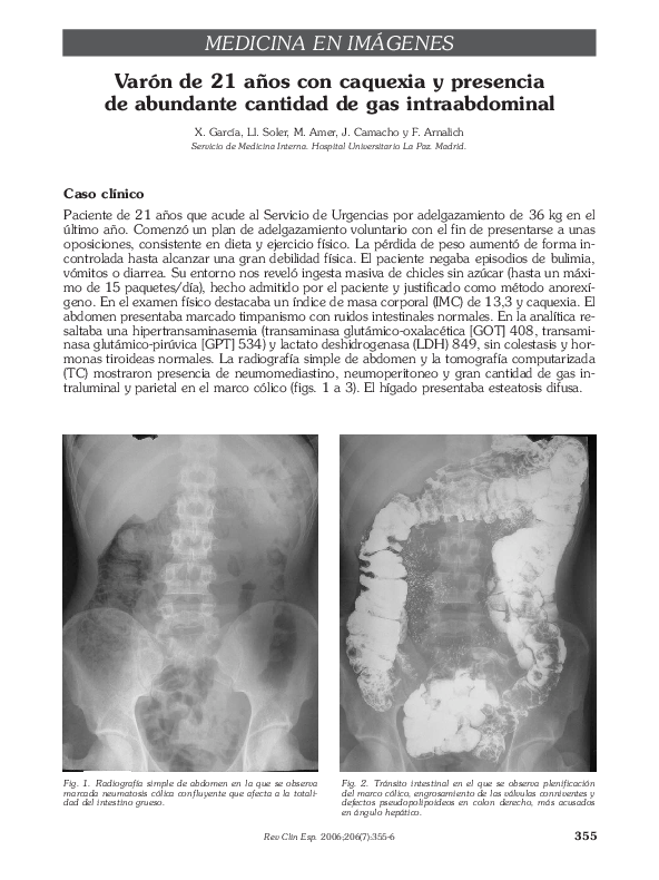 (PDF) Varón de 21 años con caquexia y presencia de abundante cantidad ...