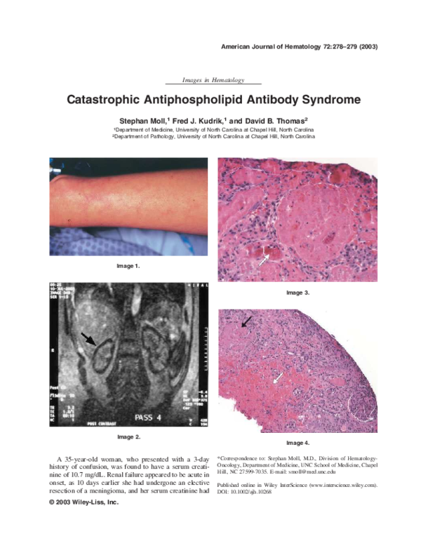 (PDF) Catastrophic antiphospholipid antibody syndrome