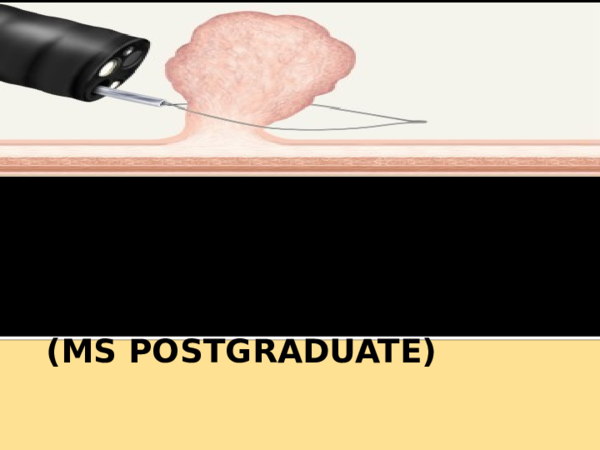 (PPT) GASTROINTESTINAL POLYPS AND UGI SCOPY