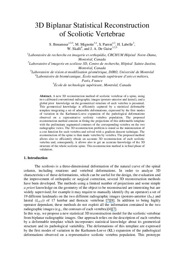 Pdf Three Dimensional Surface Rendering Reconstruction Of Scoliotic
