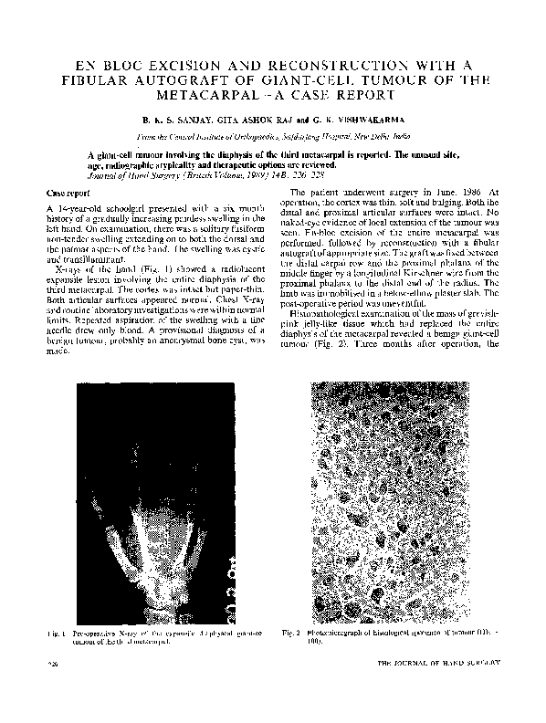 (PDF) En Bloc Excision and Reconstruction with a Fibular Autograft of ...