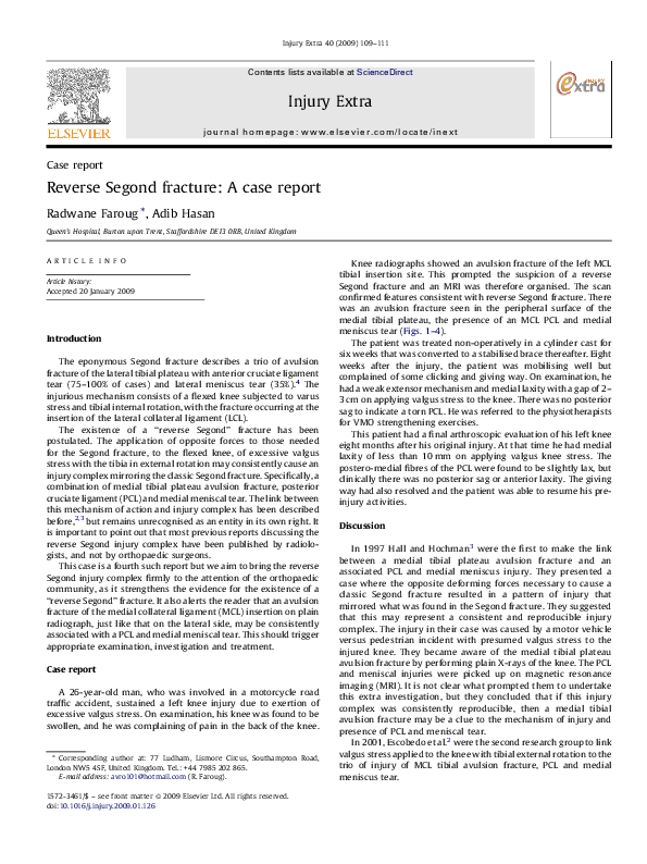(PDF) Reverse Segond fracture: A case report
