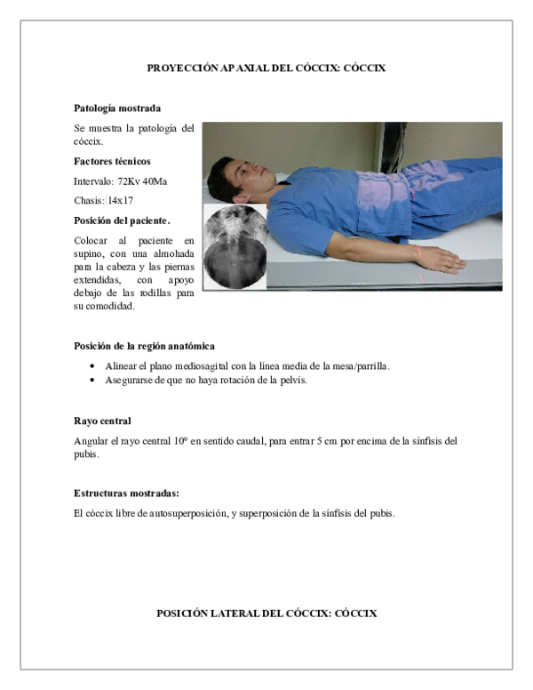 (DOC) PROYECCIÓN AP AXIAL DEL CÓCCIX: CÓCCIX Patología mostrada