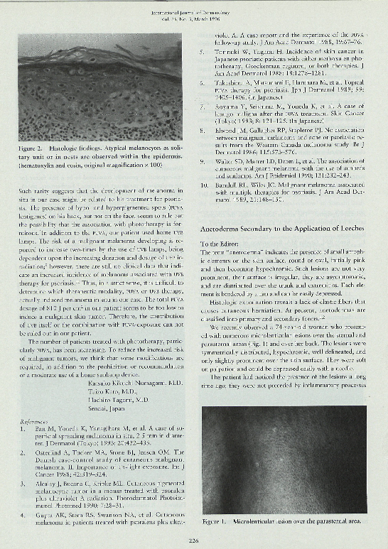 (PDF) Anetoderma Secondary to the Application of Leeches