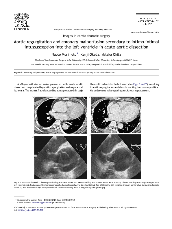 (PDF) Aortic regurgitation and coronary malperfusion secondary to ...