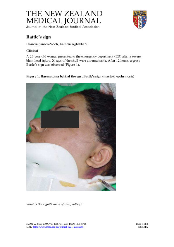 (PDF) Medical image. Battle's sign | Hossein Sanaei-Zadeh - Academia.edu