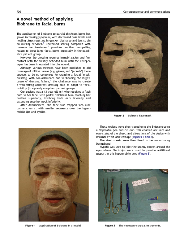 (PDF) A novel method of applying Biobrane to facial burns