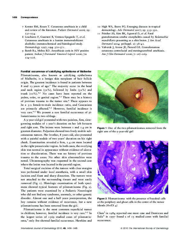 (PDF) Familial occurrence of calcifying epithelioma of Malherbe