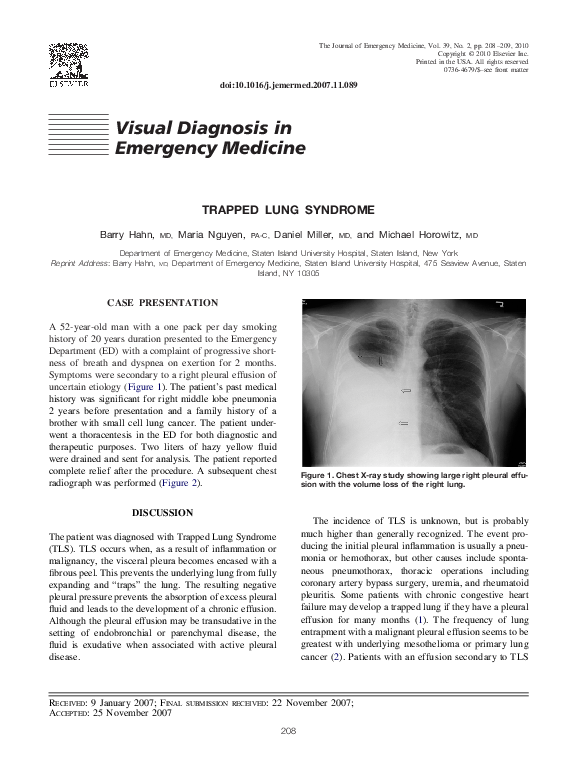(PDF) Trapped Lung Syndrome