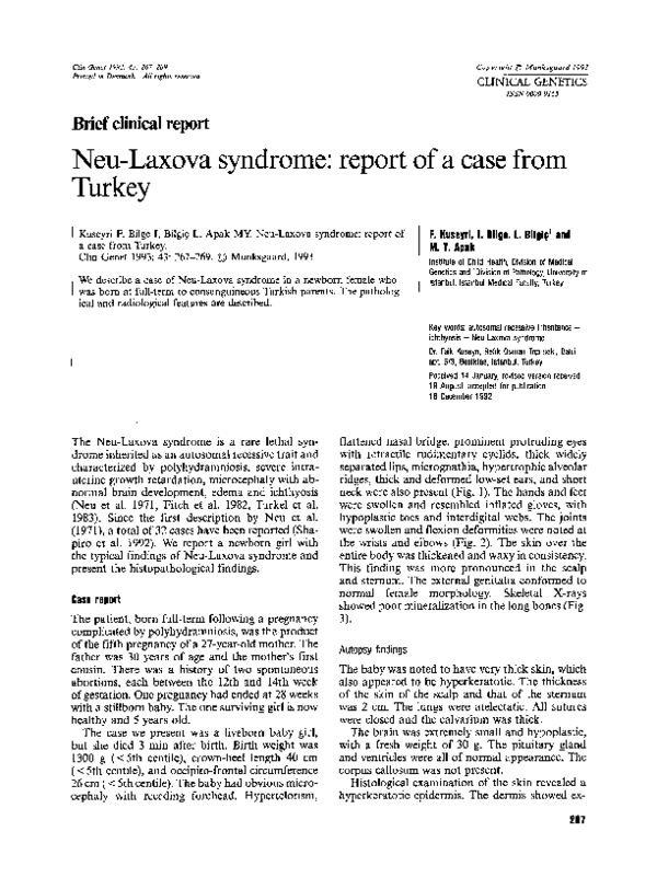 (PDF) Neu-Laxova sendromu: olgu türkiye'den