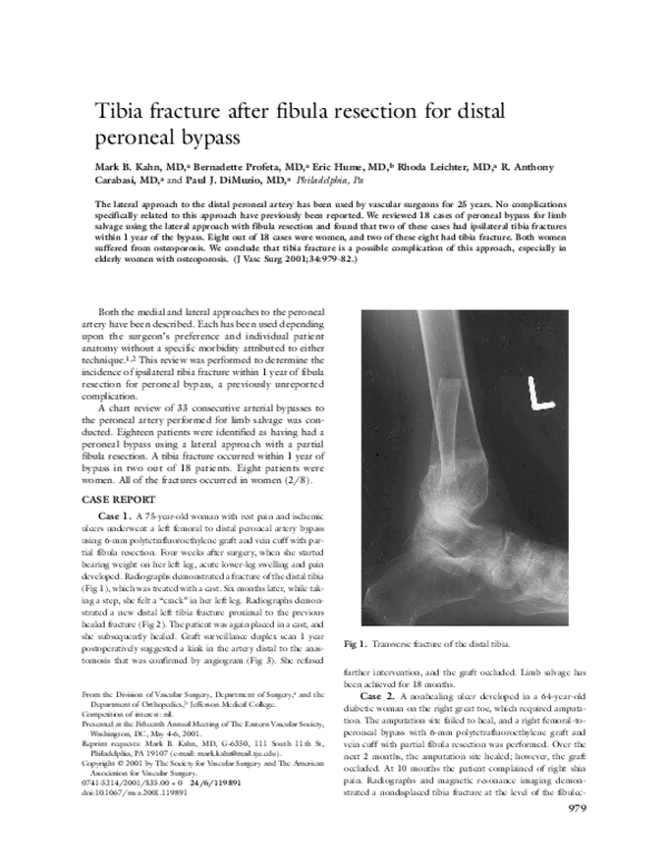 (PDF) Tibia fracture after fibula resection for distal peroneal bypass