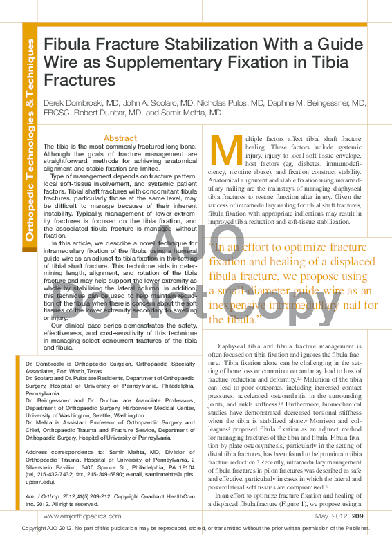 (PDF) Fibula fracture stabilization with a guide wire as supplementary ...