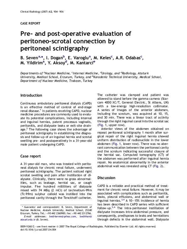 (PDF) Pre and post-operative evaluation of peritoneo-scrotal connection ...