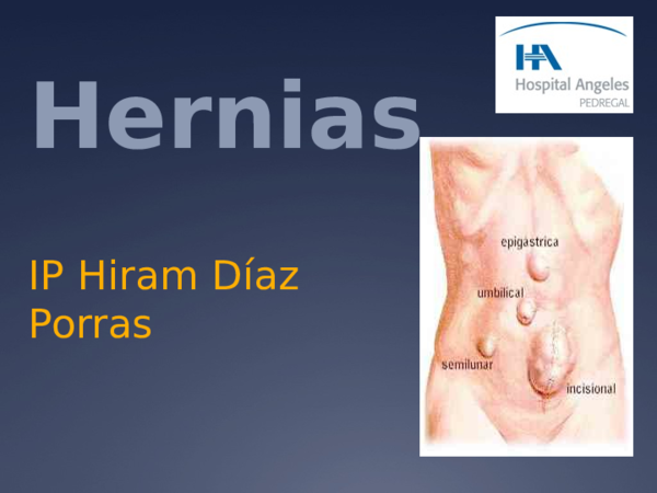 (PPT) Hernias hiram