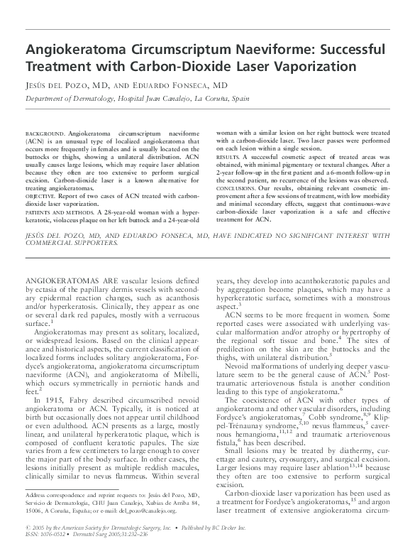 (PDF) Angiokeratoma Circumscriptum Naeviforme: Successful Treatment ...
