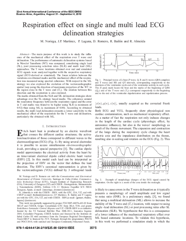 (PDF) Respiration effect on single and multi lead ECG delineation strategies