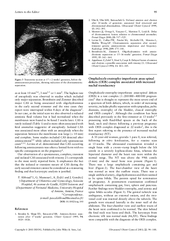 Oeis Complex Abdominal Wall Defects: Omphalocele | NCBDDD | CDC