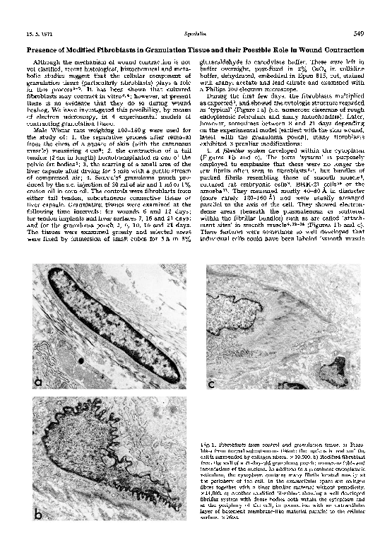 (PDF) Presence of modified fibroblasts in granulation tissue and their ...