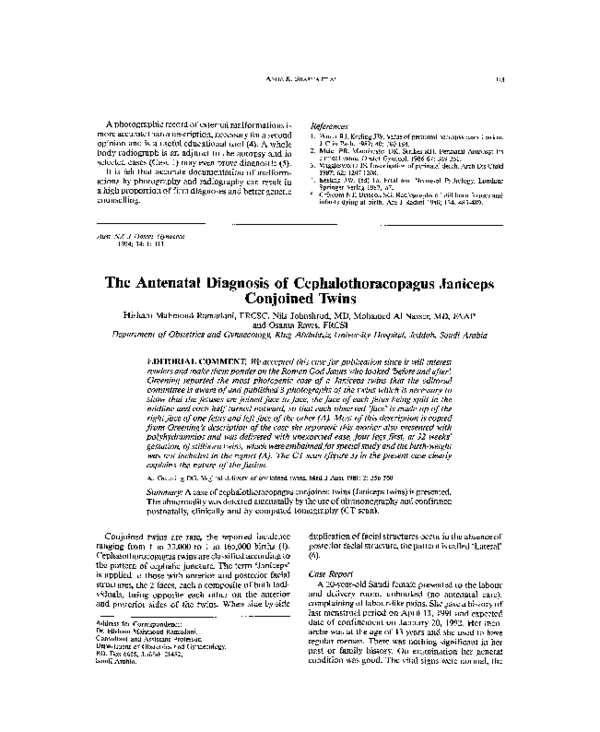 (PDF) The Antenatal Diagnosis of Cephalothoracopagus Janiceps Conjoined ...