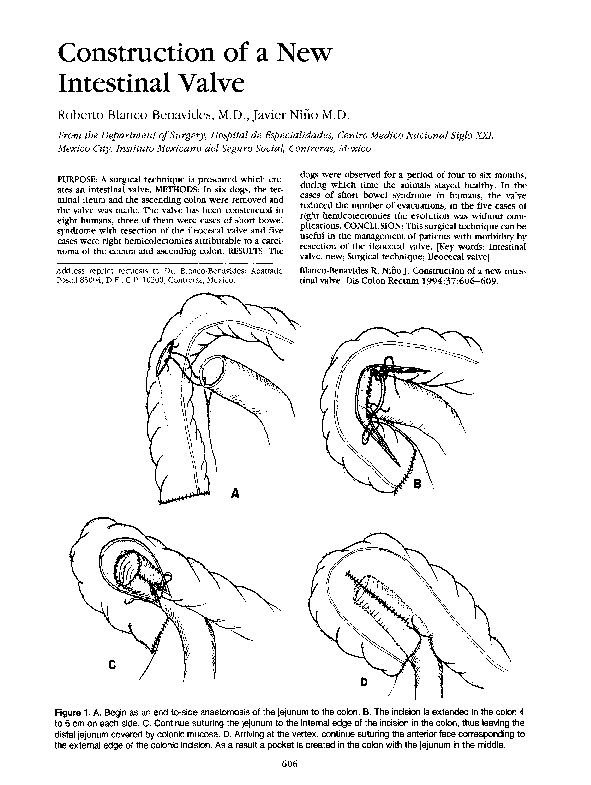 (PDF) Construction of a new intestinal valve