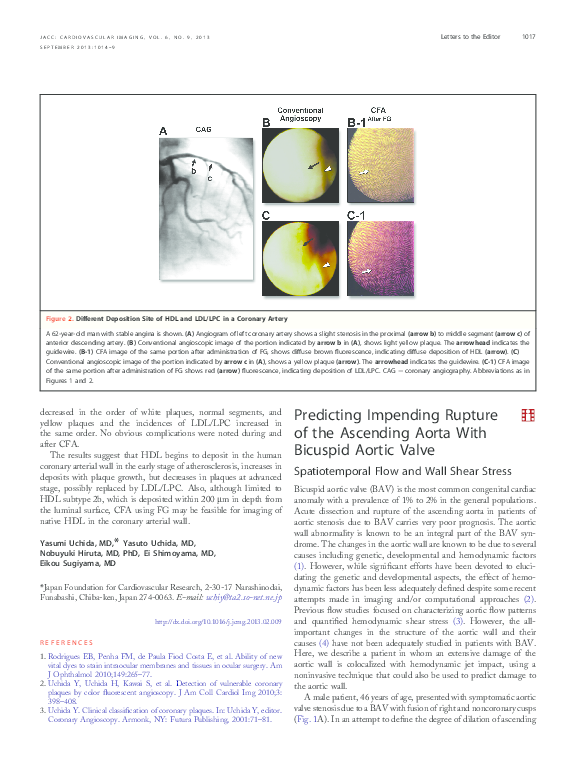(PDF) Predicting Impending Rupture of the Ascending Aorta With Bicuspid ...