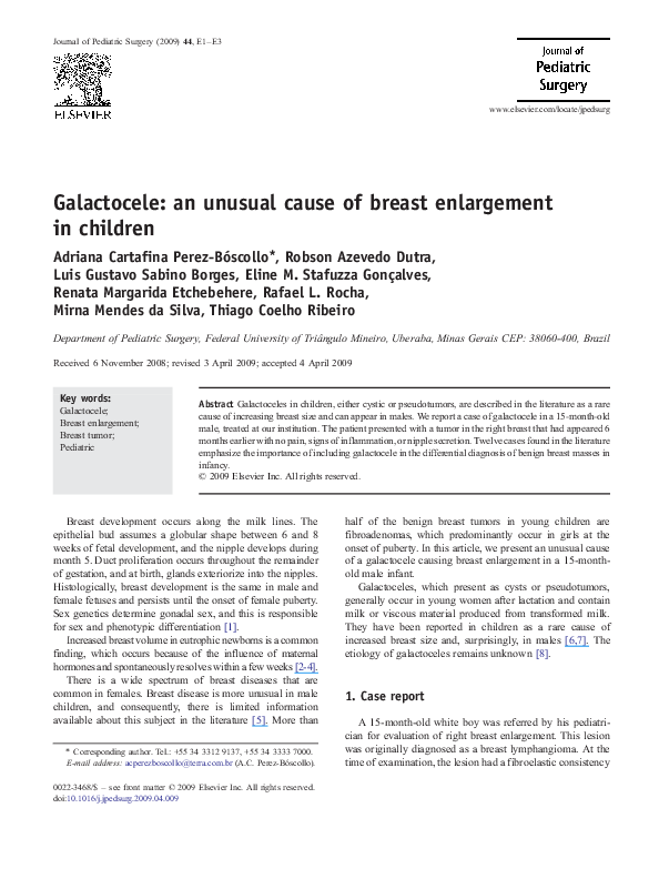 (PDF) Galactocele: an unusual cause of breast enlargement in children