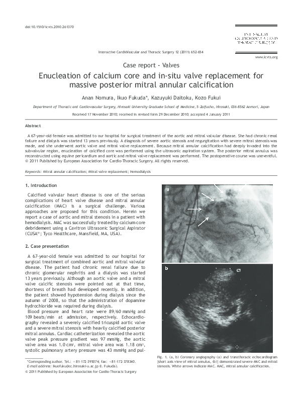 (PDF) Enucleation of calcium core and in-situ valve replacement for ...