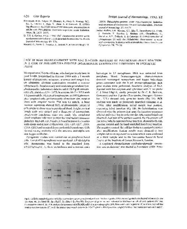 (PDF) LACK OF M-bcr REARRANGEMENT WITH b3a2 JUNCTION REVEALED BY ...
