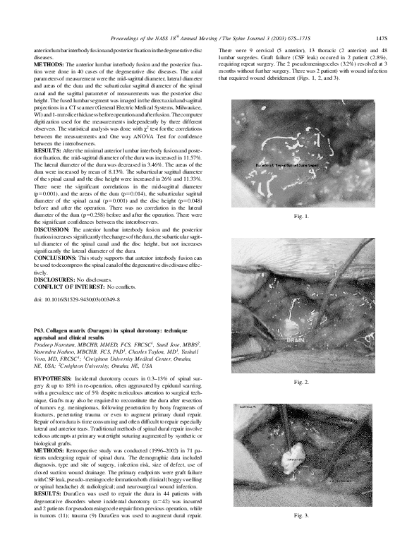(PDF) P63. Collagen matrix (Duragen) in spinal durotomy: technique ...