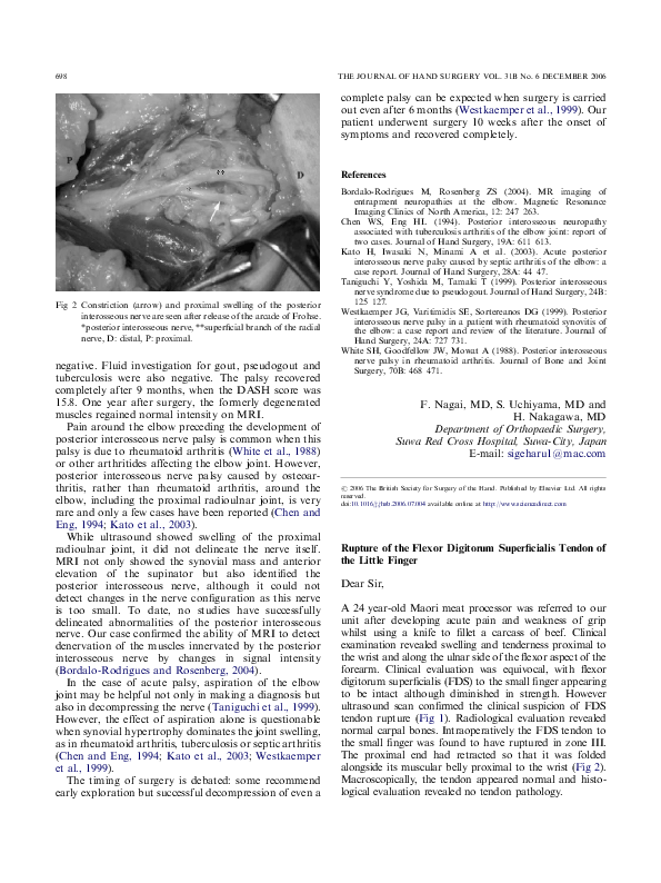 (PDF) Rupture of the Flexor Digitorum Superficialis Tendon of the ...