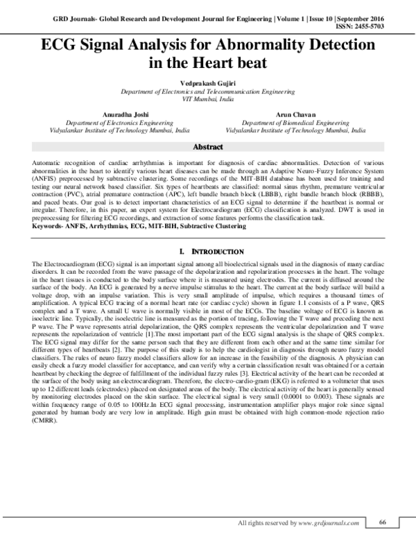 Pdf Ecg Signal Analysis For Abnormality Detection In The Heart Beat