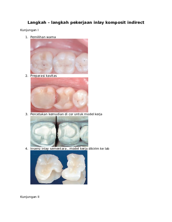 (DOC) Langkah – langkah pekerjaan inlay komposit indirect