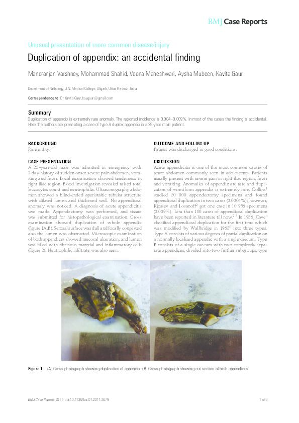 (PDF) Duplication of appendix: an accidental finding