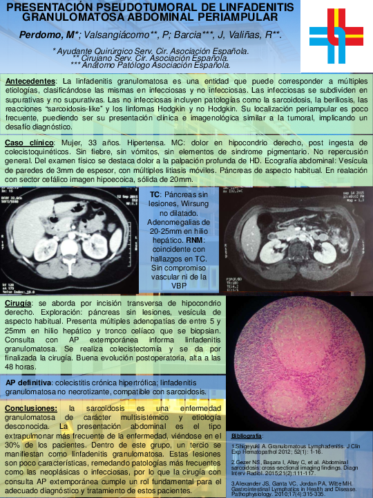 (PDF) PRESENTACIÓN PSEUDOTUMORAL DE LINFADENITIS GRANULOMATOSA ...