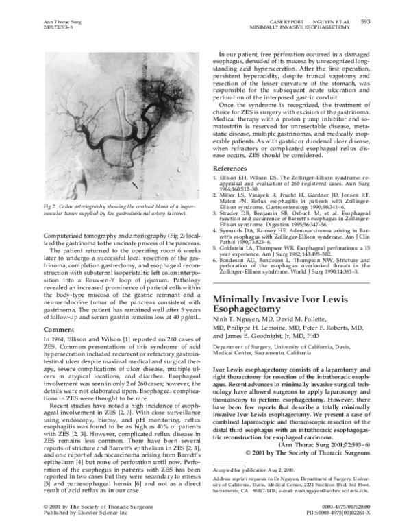 (PDF) Minimally invasive Ivor Lewis esophagectomy