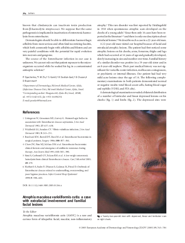 (PDF) Atrophia maculosa varioliformis cutis: a case with extrafacial ...