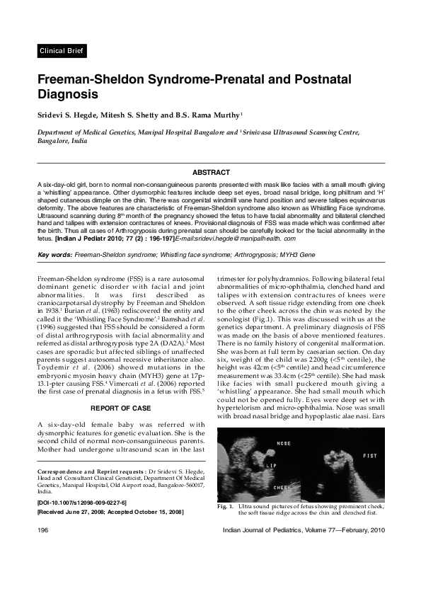 (PDF) Freeman-Sheldon syndrome--prenatal and postnatal diagnosis