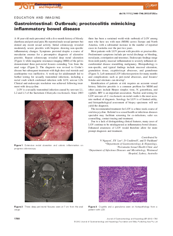 (PDF) Gastrointestinal: Outbreak; proctocolitis mimicking inflammatory ...