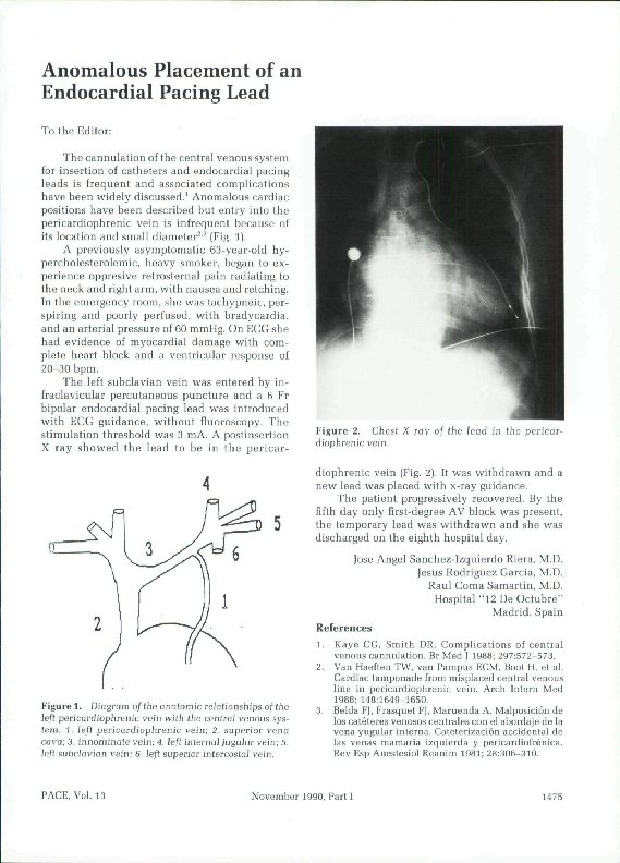 (PDF) Anomalous Placement of an Endocardial Pacing Lead