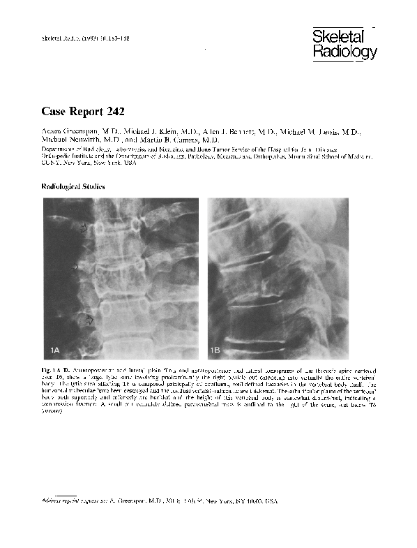 (PDF) Epiconus syndrome induced only in the erect standing position in ...