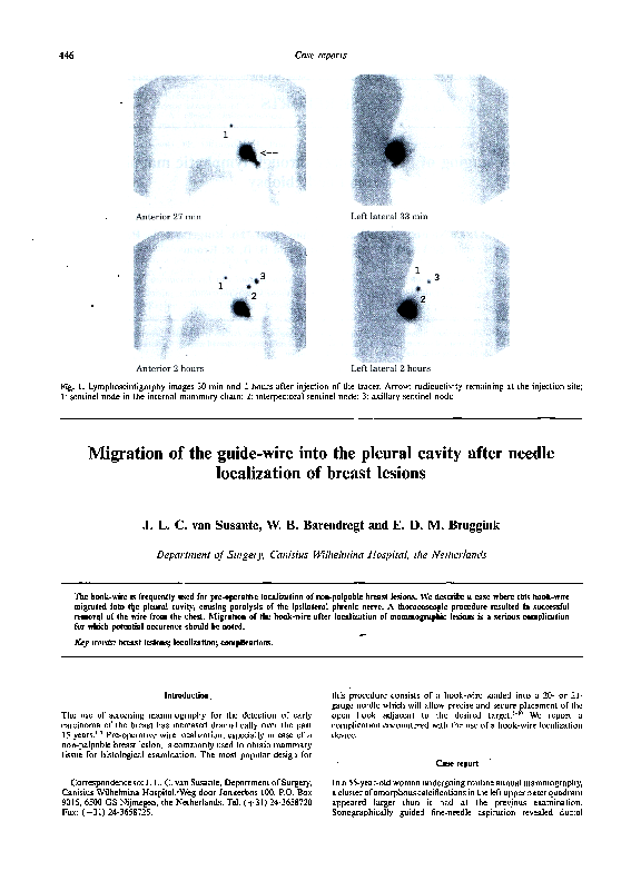 (PDF) Migration of the guide-wire into the pleural cavity after needle ...