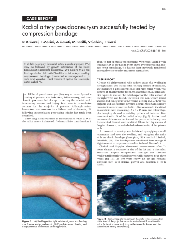 (PDF) Radial artery pseudoaneurysm successfully treated by compression ...