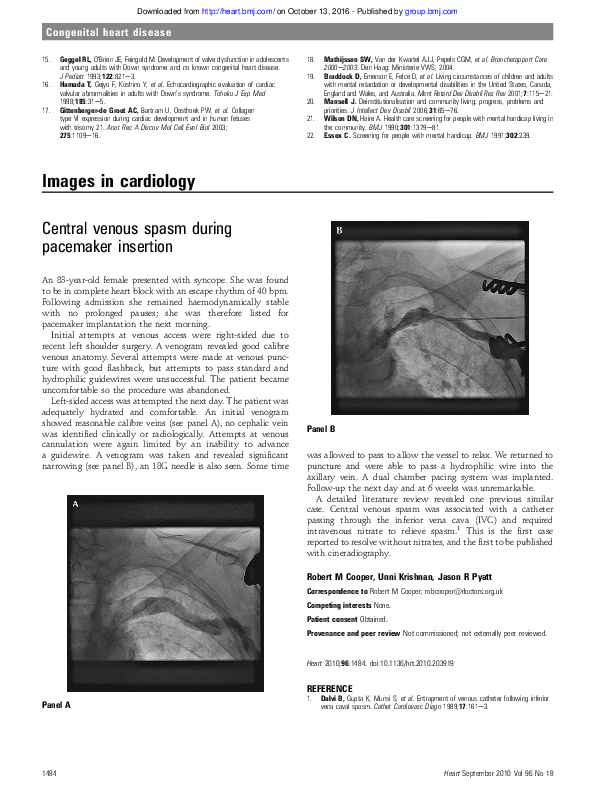 (PDF) Central venous spasm during pacemaker insertion
