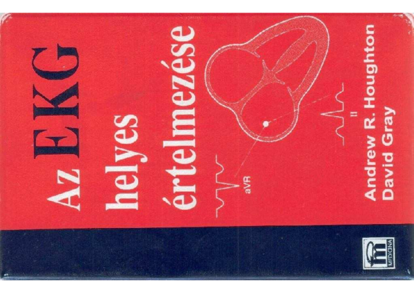 (PDF) Az EKG helyes értelmezése