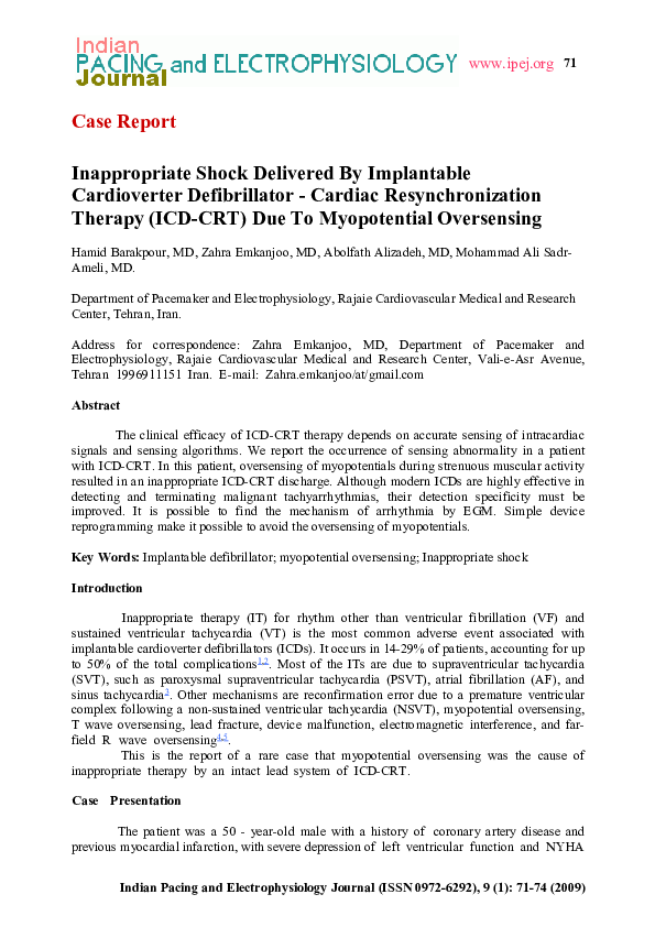 (PDF) Inappropriate Shock delivered by Implantable Cardioverter ...